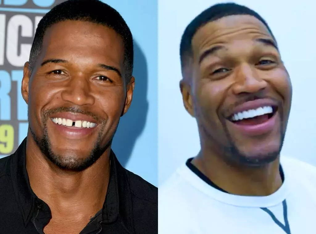 Michael Strahan se deshace de su icónico hueco dental - ¡Mira el video!