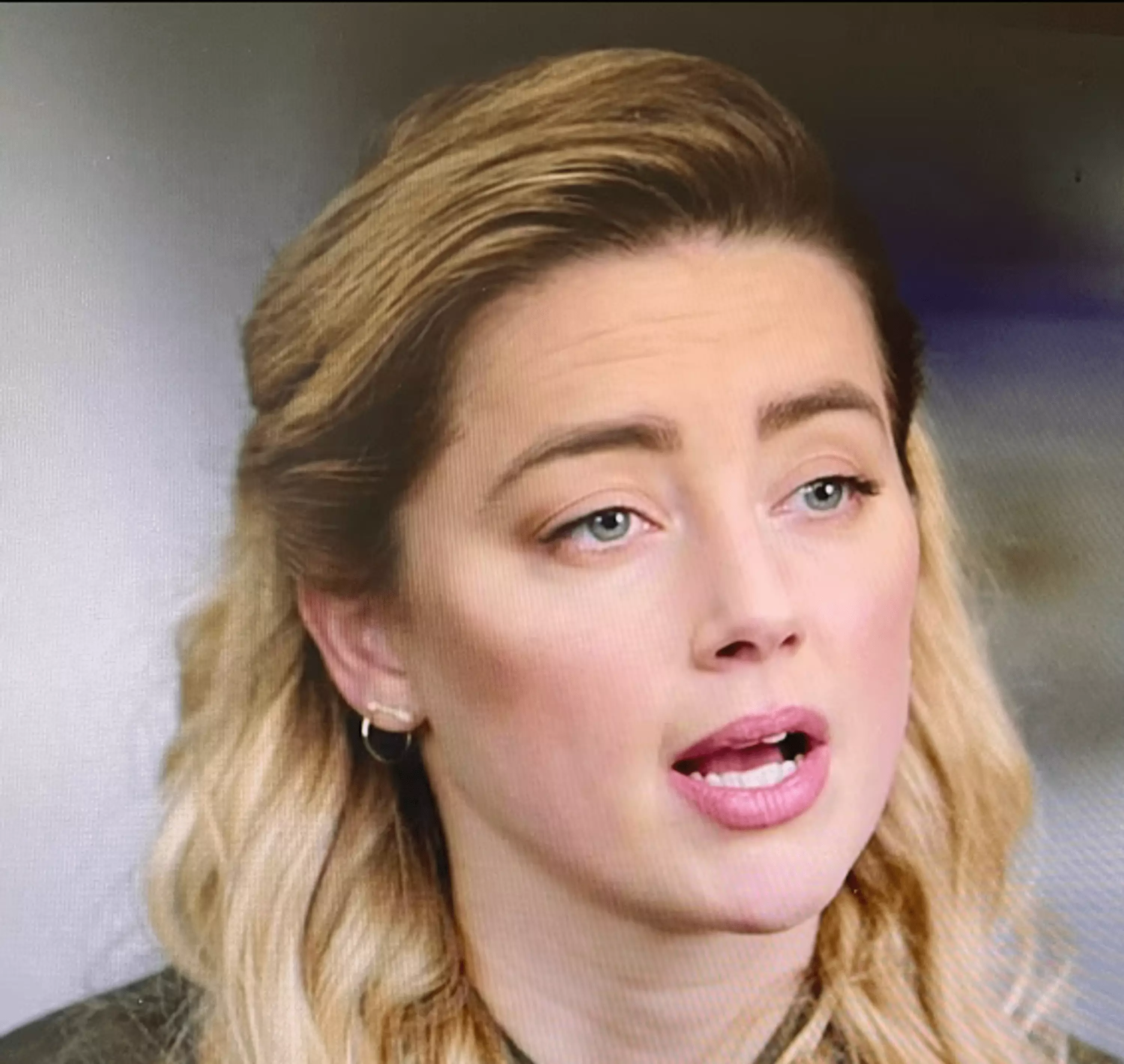 Amber Heard جوننىي دېپنىڭ ئۇنى خورلىغانلىقىنىڭ ئىسپاتى سۈپىتىدە داۋالاش دوختۇرىنىڭ خاتىرىسىنى ئېلان قىلدى